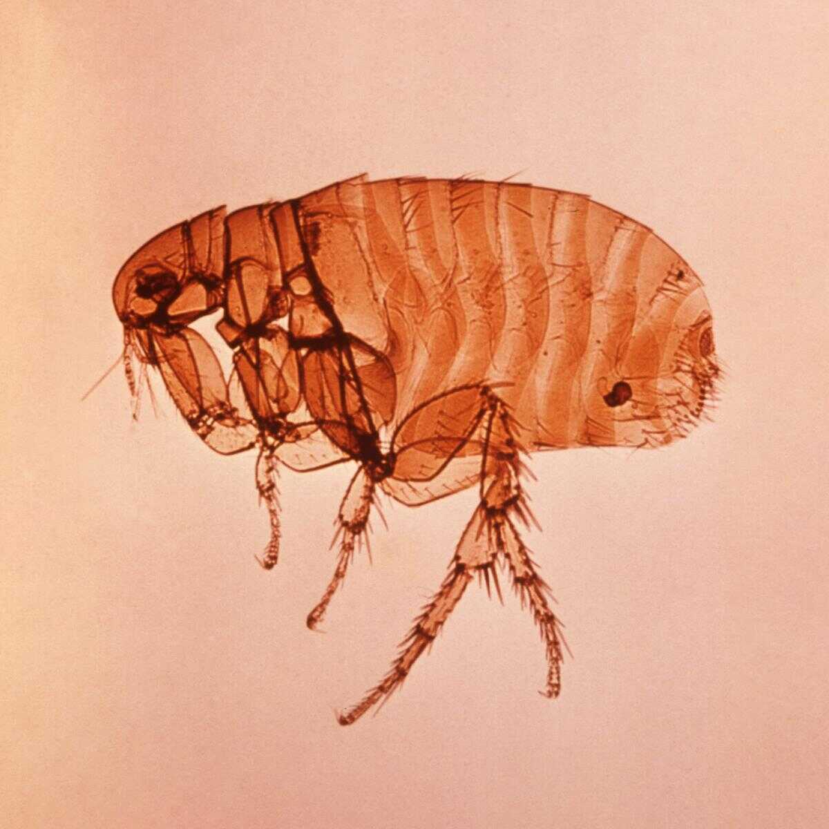 Can Fleas Live in Human Hair? | On Demand Pest Control